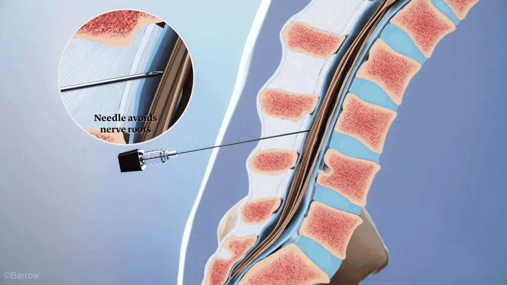 Ortho Globe | Spinal Injections: Pain Relief and Diagnosis Guid