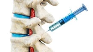 Ortho Globe | Comprehensive Guide to Spinal Injections