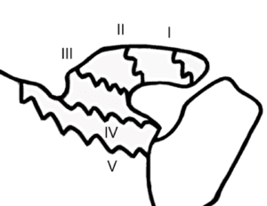 Ortho Globe | Coracoid Fractures