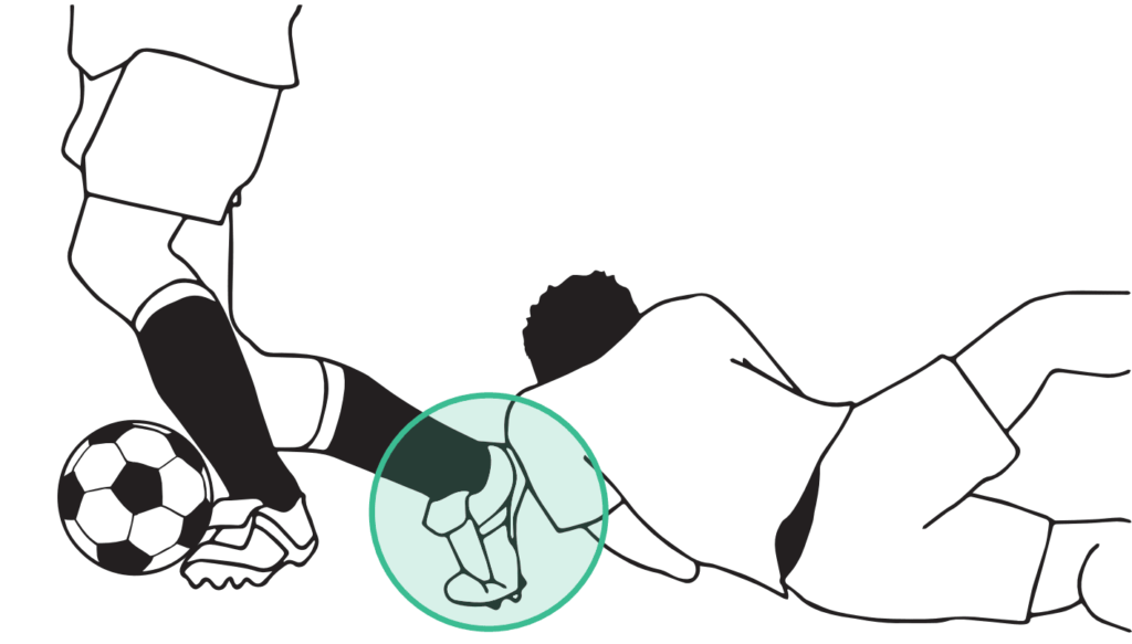 Ortho Globe | Understanding Lisfranc Injuries: Causes, Symptoms, and ...