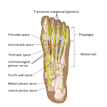 Ortho Globe | Understanding Morton's Neuroma: Symptoms, Causes, and ...